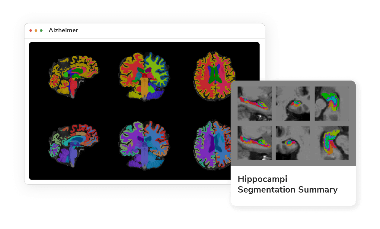 Cutting-edge Neuroimaging Biomarkers for Alzheimer Research