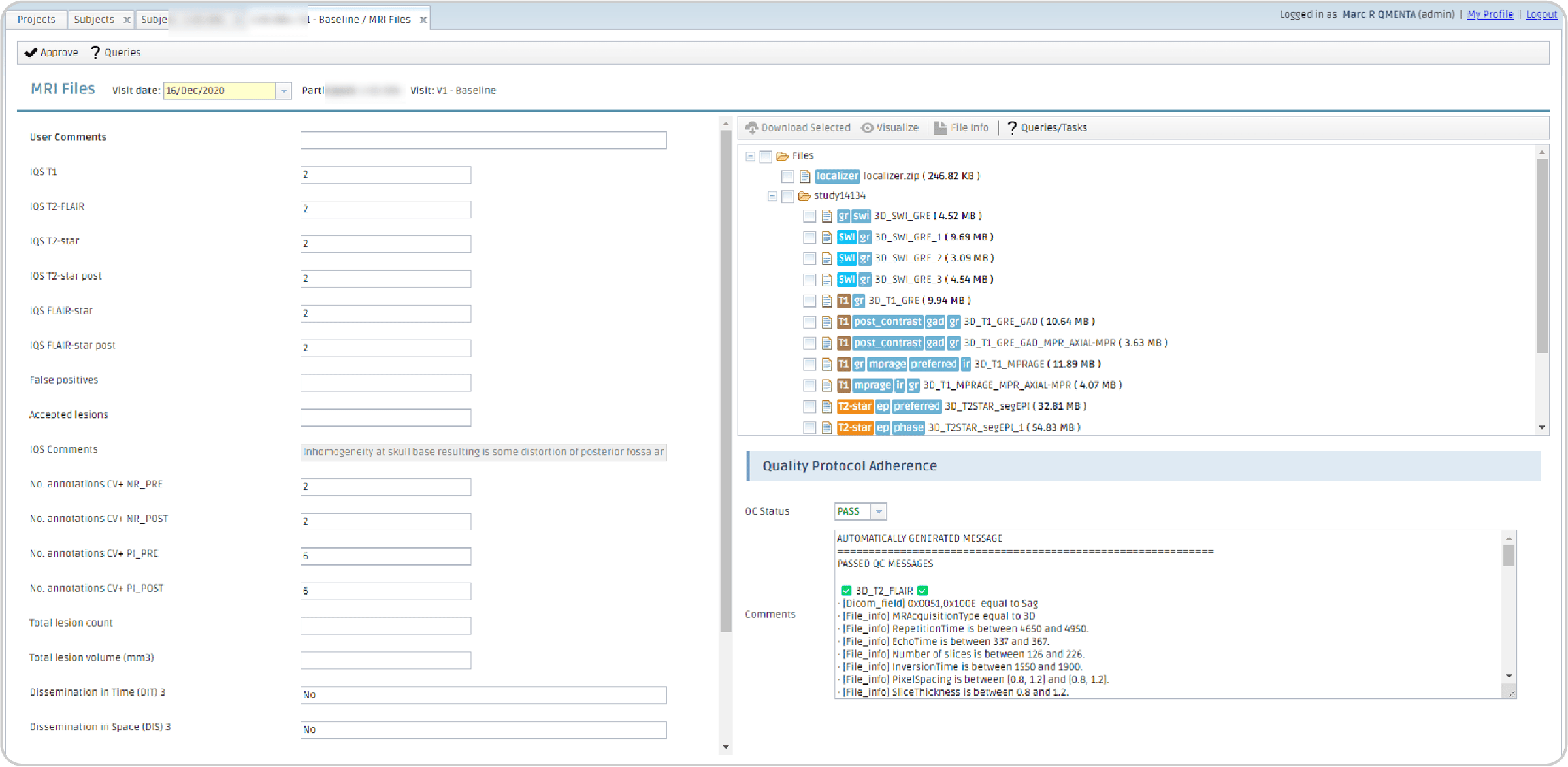 Improving Multiple Sclerosis Diagnosis: Automating Central Vein Sign ...