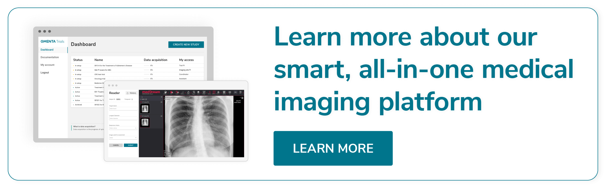 The top 4 open-source software tools to measure cortical brain ...