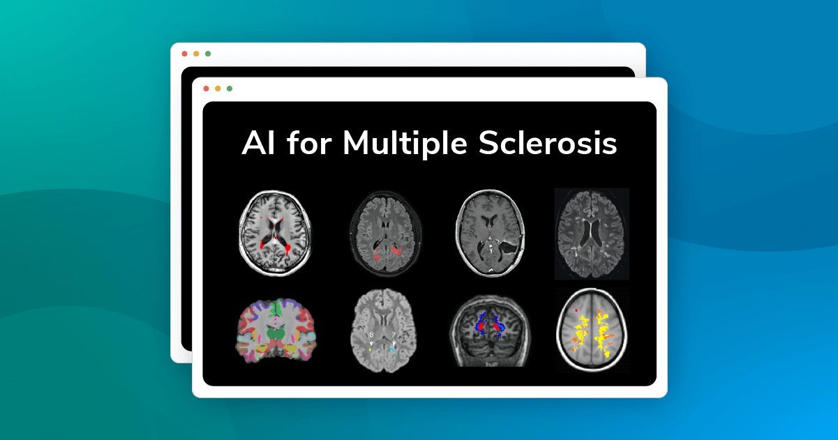 Specialized Imaging Biomarkers for Multiple Sclerosis
